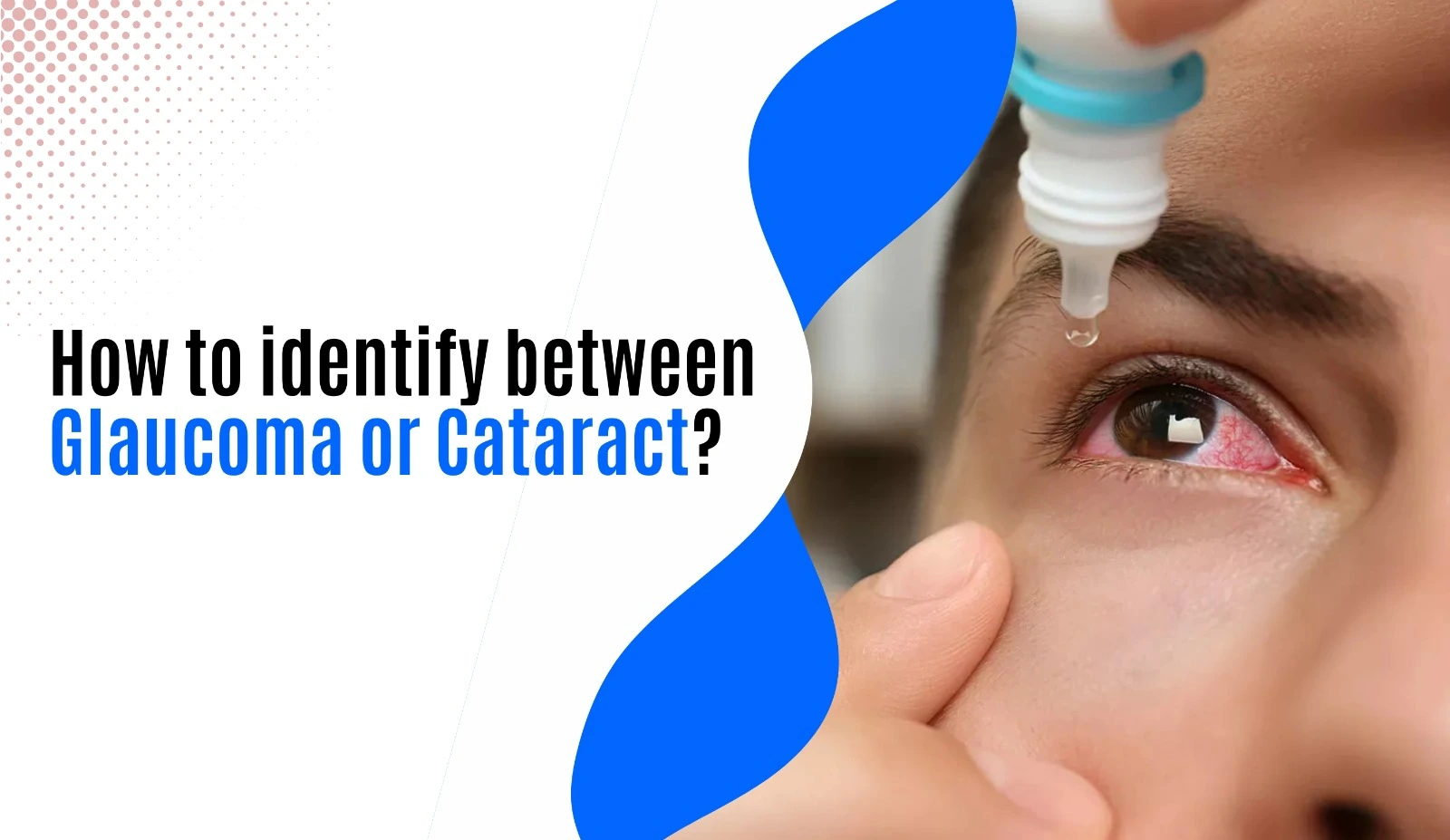 How to identify between Glaucoma or Cataract?