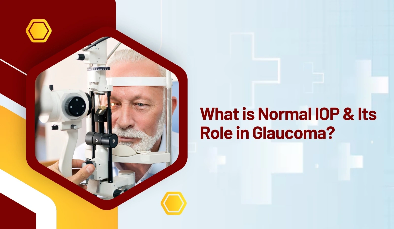 What is Normal IOP & Its Role in Glaucoma?